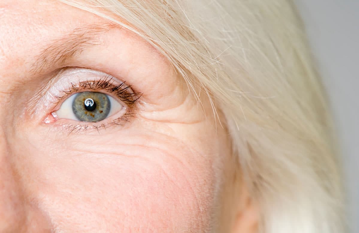 Facial Wrinkle Stockton CA - Anti-aging Modesto CA